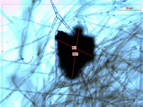 A Culture Of M Phaseolina Isolated From Charcoal Rot Of Soybean Stem