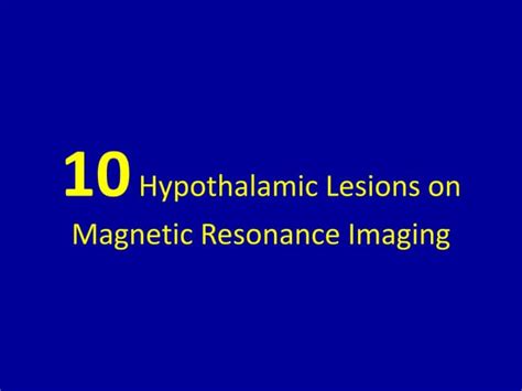 10 Hypothalamic Lesions On Magnetic Resonance Imaging Pptx