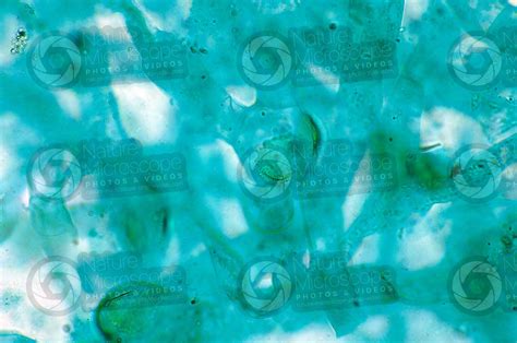 Bryophyta Moss Protonema 500x Bryophyta Mosses Bryophyta