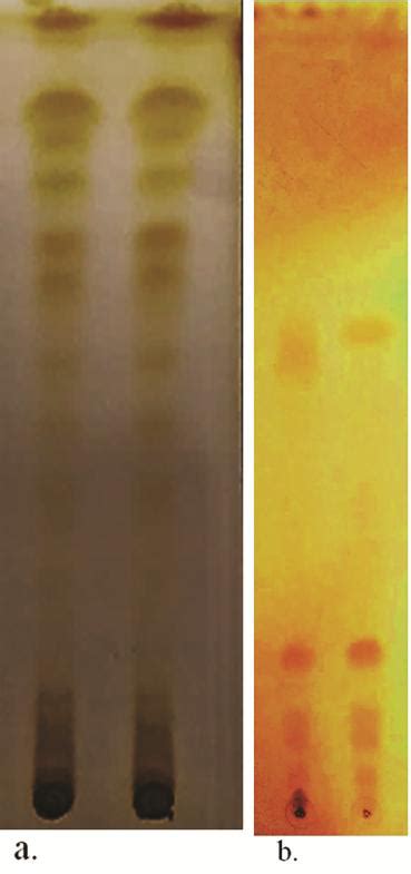 A Thin Layer Chromatography Analysis Showed The Presence Of Various Download Scientific