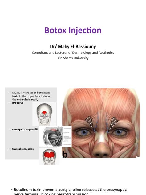 Botox Injection Training Pdf Botulinum Toxin Clinical Medicine
