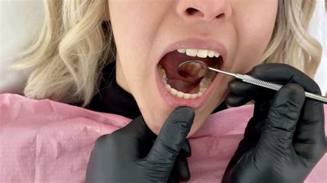 Dental Cleaning Full Mouth And Permanent Retainer Femmefantasy Clips4sale