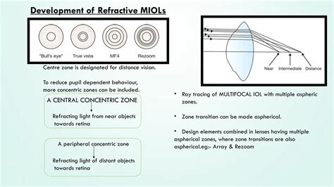 Lets Learn Everything About Multifocal Iol Pptx