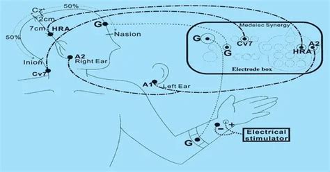 Somatosensory Electrical Stimulations Impact On Hand Selection