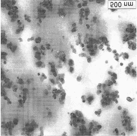 The Typical Tem Image Of Ccpp Composite With 15 Vol Filler Loading Download Scientific