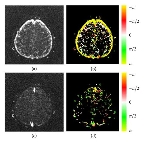 transfer function analysis of the dynamic images shown in figure 4 the