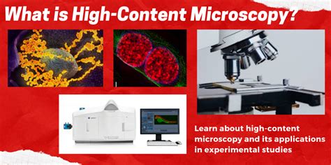 What Is High Content Microscopy Bit 479 579 High Throughput Discovery