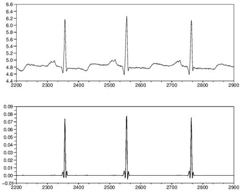 Ecg Signal And Its Indicator Signal Bottom For R Peak Detection