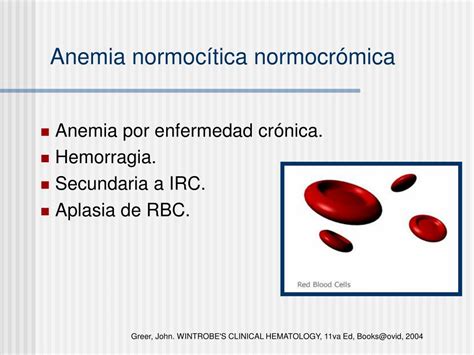 O Que é Anemia Normocítica Normocrômica Retoedu