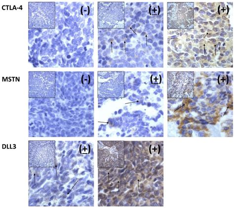 Immunohistochemical Staining Of Ctla 4 Mstn And Dll3 In Sclc Tissues