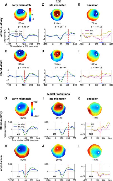 data and modeling of auditory attention on mismatch and omission