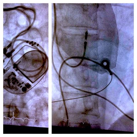 Dr Nabil Paktins Journal Of Cardiovascular Medicine Blog ژورنال قلب