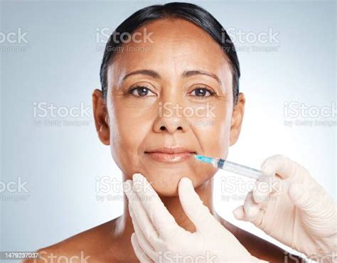 주사 입술 필러 및 성형 수술 화장품 및 미용 임플란트를 위한 여성 얼굴의 초상화 스킨케어 페이셜 주사기 및 보톡스 미학은 지방