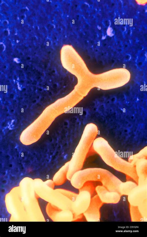 Gram Positive Bacterium Bifidobacterium Banque De Photographies Et D
