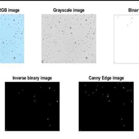 Slide Sample Analyses Microscopically Shows Positive Agglutination