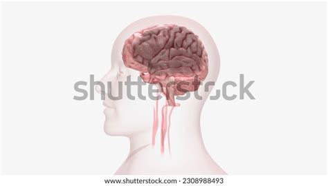 344 Carotid Artery Stenosis Royalty Free Photos And Stock Images