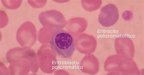 Fichero De Hematología Eritroblasto Policromático Normoblasto