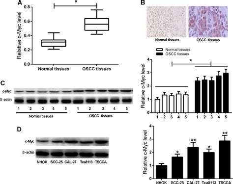 C Myc Is Upregulated In Oscc Tissues And Cell Lines Ac Qrt Pcr
