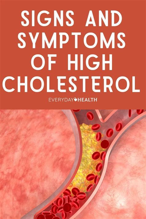 How To Lower Triglycerides Ldl Cholesterol Artofit