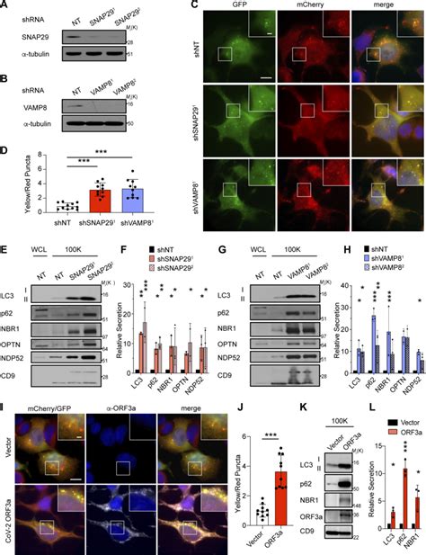Genetic Inhibition Of Autophagosome Lysosome Fusion Promotes The Download Scientific Diagram