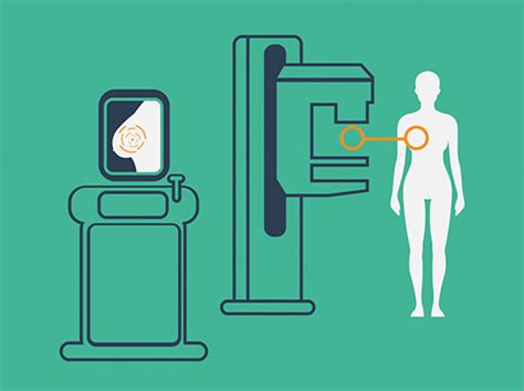 Ai Based Screening Has Increased Breast Cancer Detection