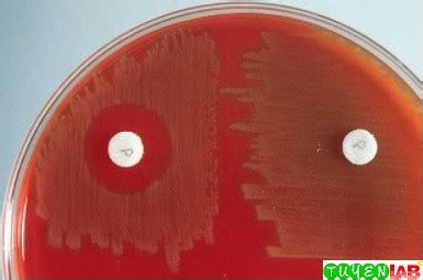 Microbiology Atlas Of Streptococcus Enterococcus And Other Catalase