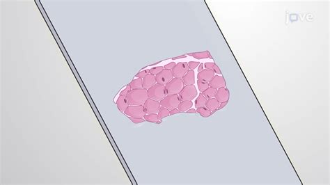 Video Visualization Of Bacteria In Bladder Biopsy Sections Via