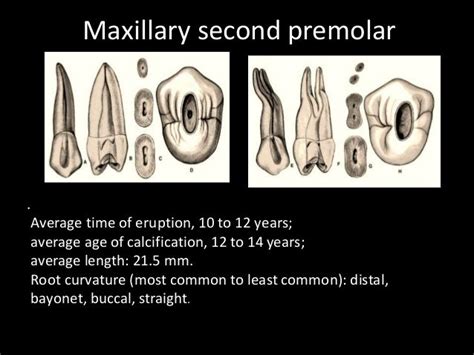 Maxillary First Premolar Canals