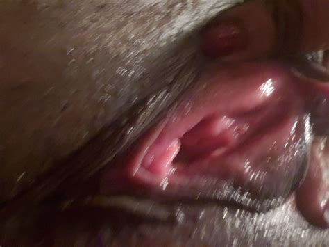 Varieties Of Vaginas Page 11 Xnxx Adult Forum Varieties Of Vaginas Page 11 Xnxx Adult Forum