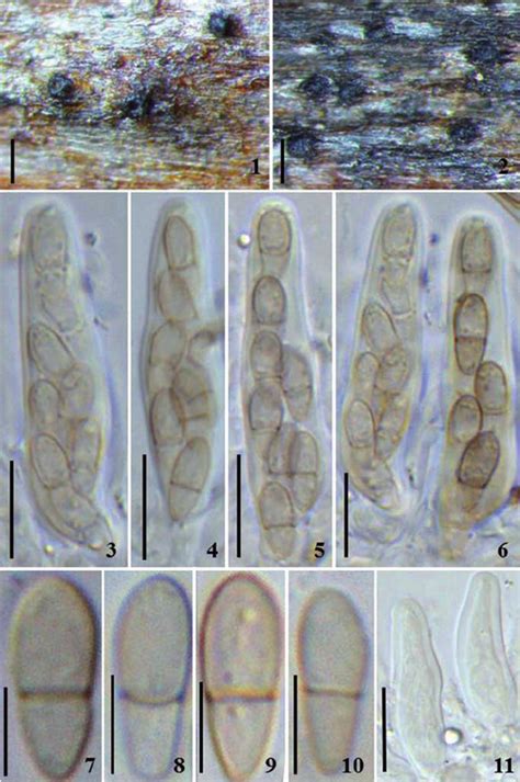 Microscopic Structures Of Venturia Chrysanthemi Zt 49108 Holotype Download Scientific