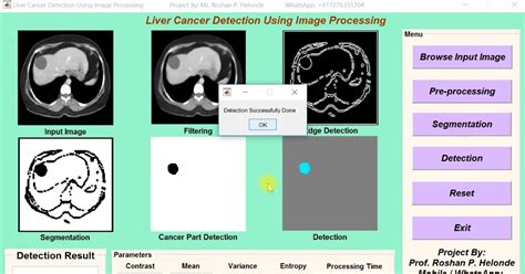 Matlab Code For Liver Cancer Detection Using Image Processing Full