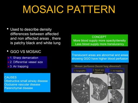 Patterns In Hrct Chest Pptx Lung And Respiratory Health Diseases And Conditions