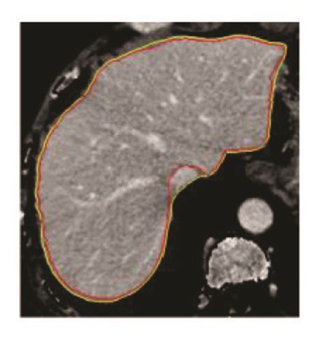 Comparisons Between Fine Segmentation Results And Ground Truth Yellow Download Scientific