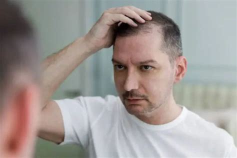 How To Regrow Hair Without Minoxidil Hn Magazine