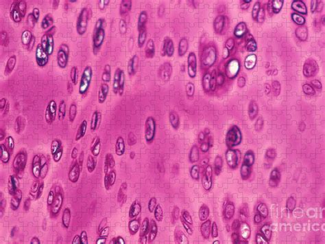 Fibrocartilage Connective Tissue