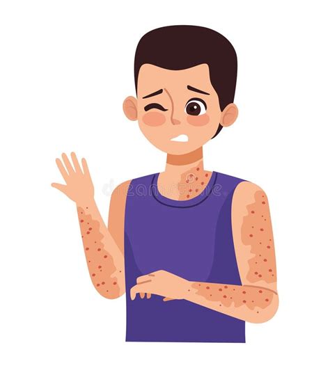 Unhealthy Man Suffer From Monkey Pox Stock Vector Illustration Of