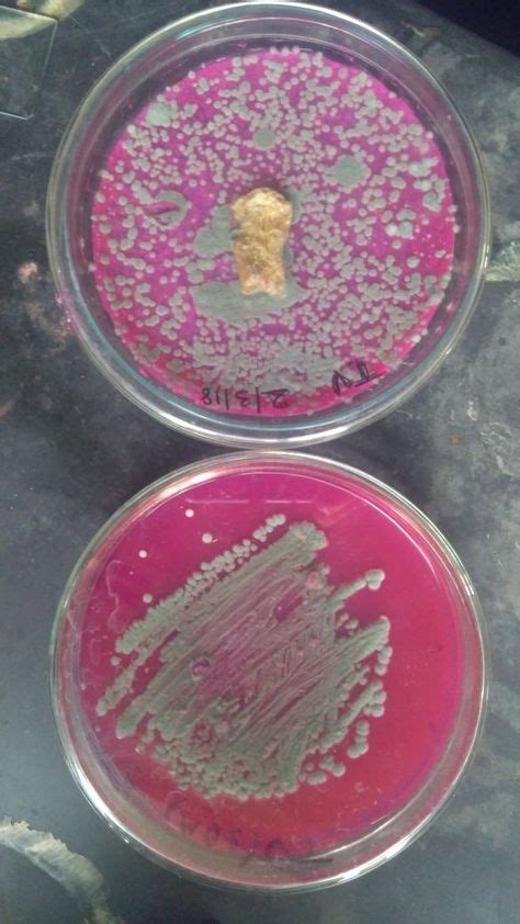 Trichoderma Viride Bio Fungicide Isolation In Selective Media