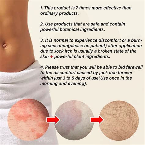 Jock Itch Cream Jock Itch Tinea Cruris Jock Itch Australia Ubuy