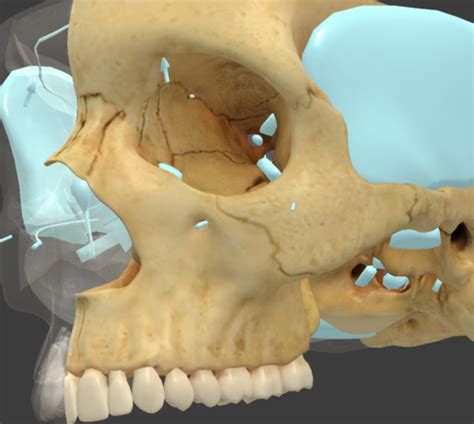 Pp Fossa And Nasal Cavity Flashcards Quizlet