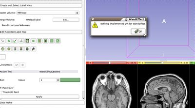 Documentation Nightly Developers EditorExtension Slicer Wiki