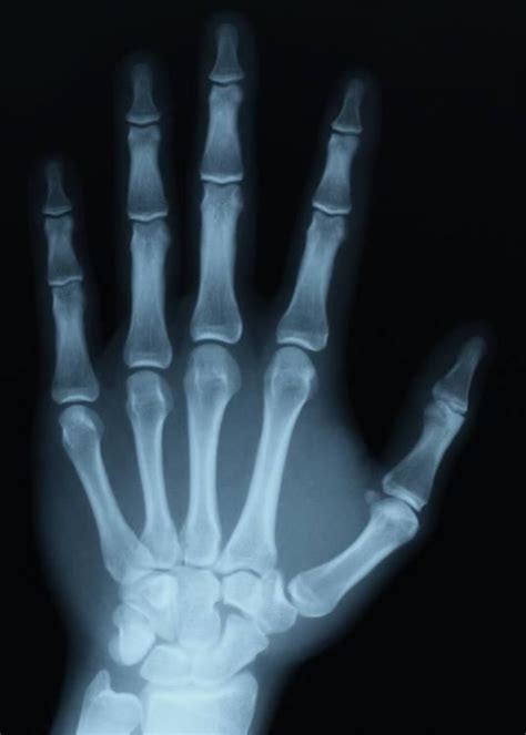 Statistical Models Of Shape And Appearance In Medical Imaging