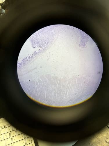 Biology 318 Lab Exam 3 Flashcards Quizlet
