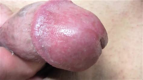 extreme close up cock treated with citric acid and cumshot at 3 40 gay