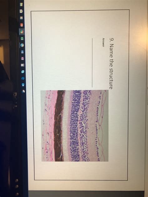 Solved Name The Structure Answer Chegg Com