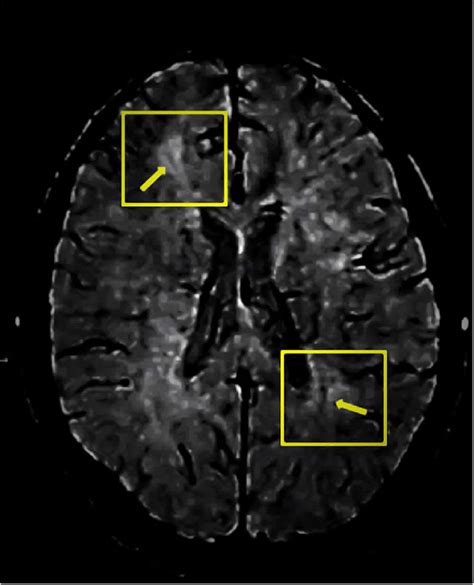 T2 Weighted Gradient Echo Mri Scan Scan Of A 19 Year Old Female Download Scientific Diagram