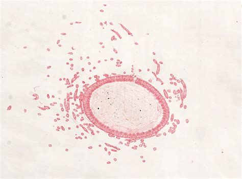 Preserved Specimen Microslide Iz Number 98945 Lot Count 1