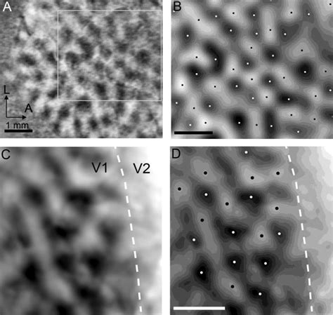 Ocular Dominance Map In V1 A And B From 1 Case C And D From A 2nd