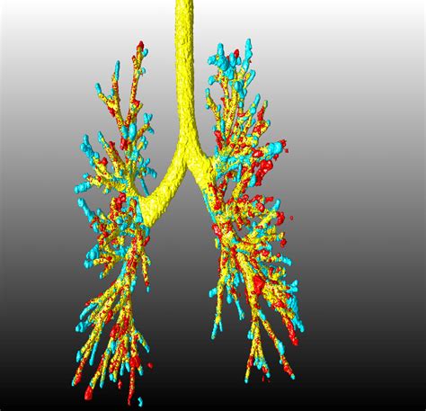 Automatic Airway Segmentation In Chest Ct Using Convolutional Neural