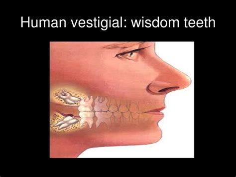 Ppt Lucy Skeleton Powerpoint Presentation Free Download Id4231590