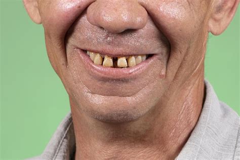 Ugly Man Face